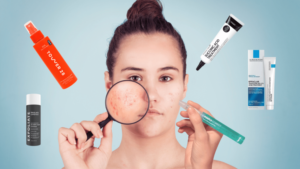 Top 5 Acne Treatments To Combat Flare-Ups - Cosmetics Report